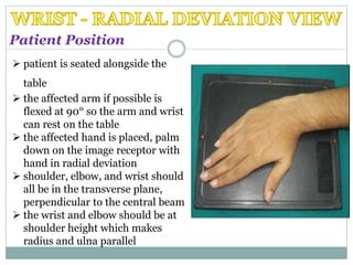Projections of carpal tunnel and wrist | PPTX
