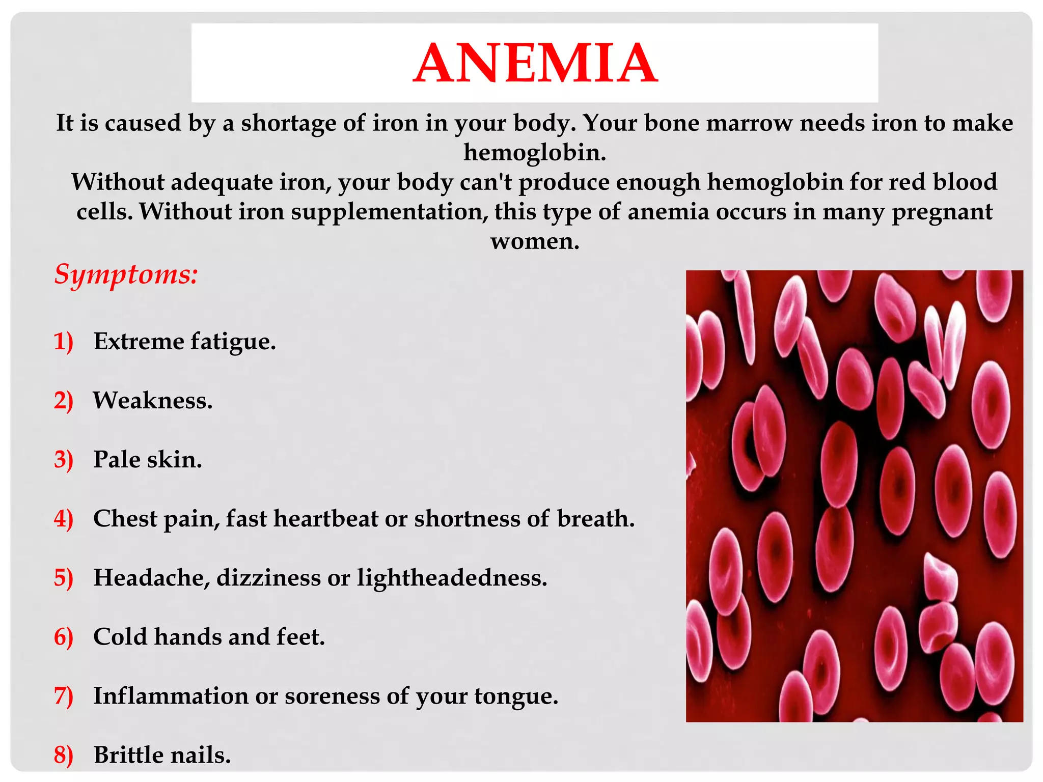 Project on deficiency diseases by naisha beri, class-5 a | PDF