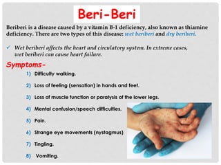Project on deficiency diseases by naisha beri, class-5 a | PDF