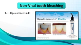 dental bleaching | PPTX