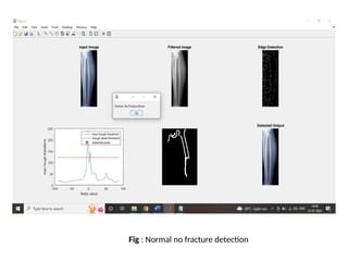 Project PPTProject PPTProject PPTProject PPT.pptx | Photo Editing Software | Computer Software ...