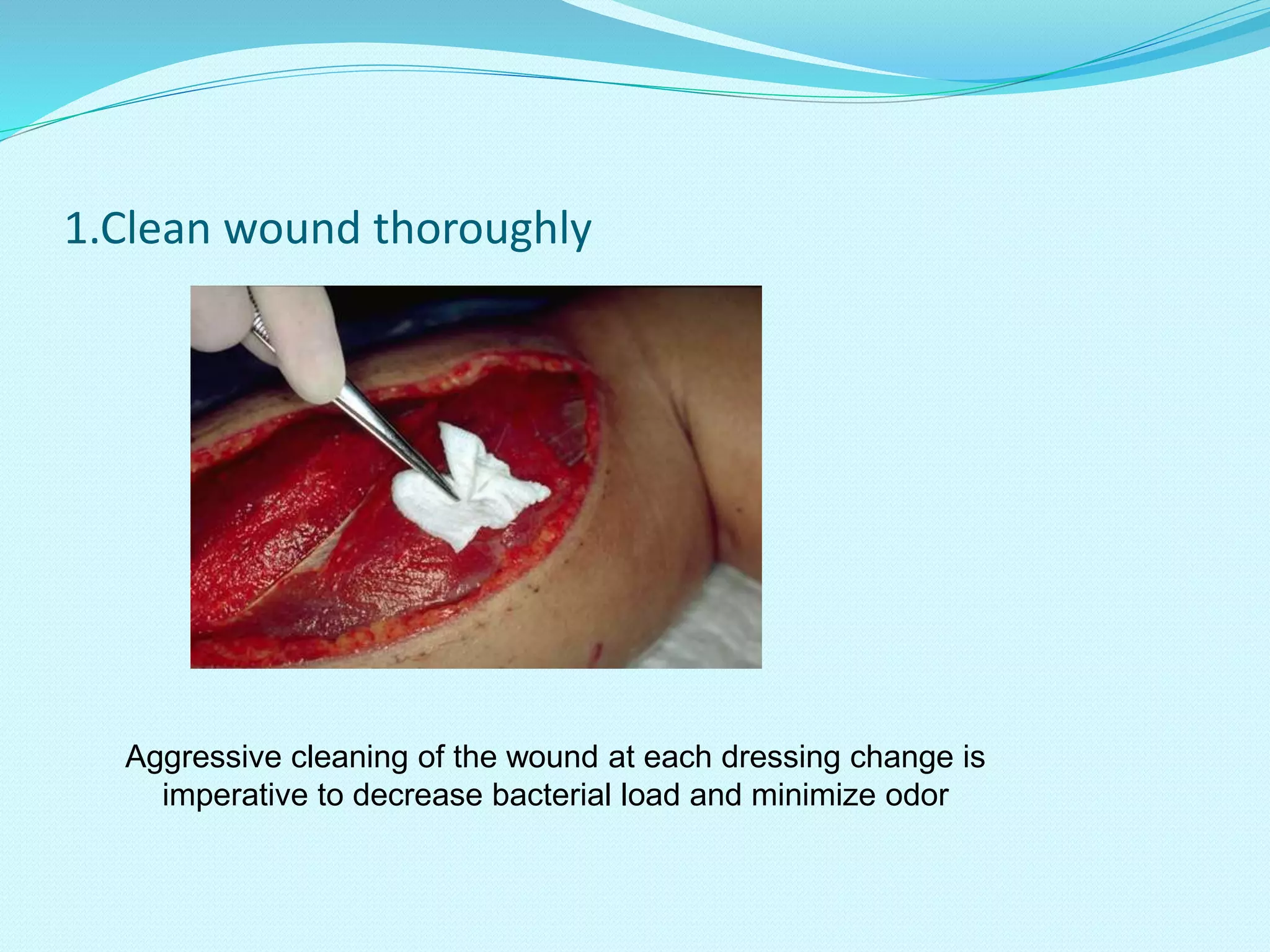 VACUUM ASSISTED WOUND THERAPY | PPTX
