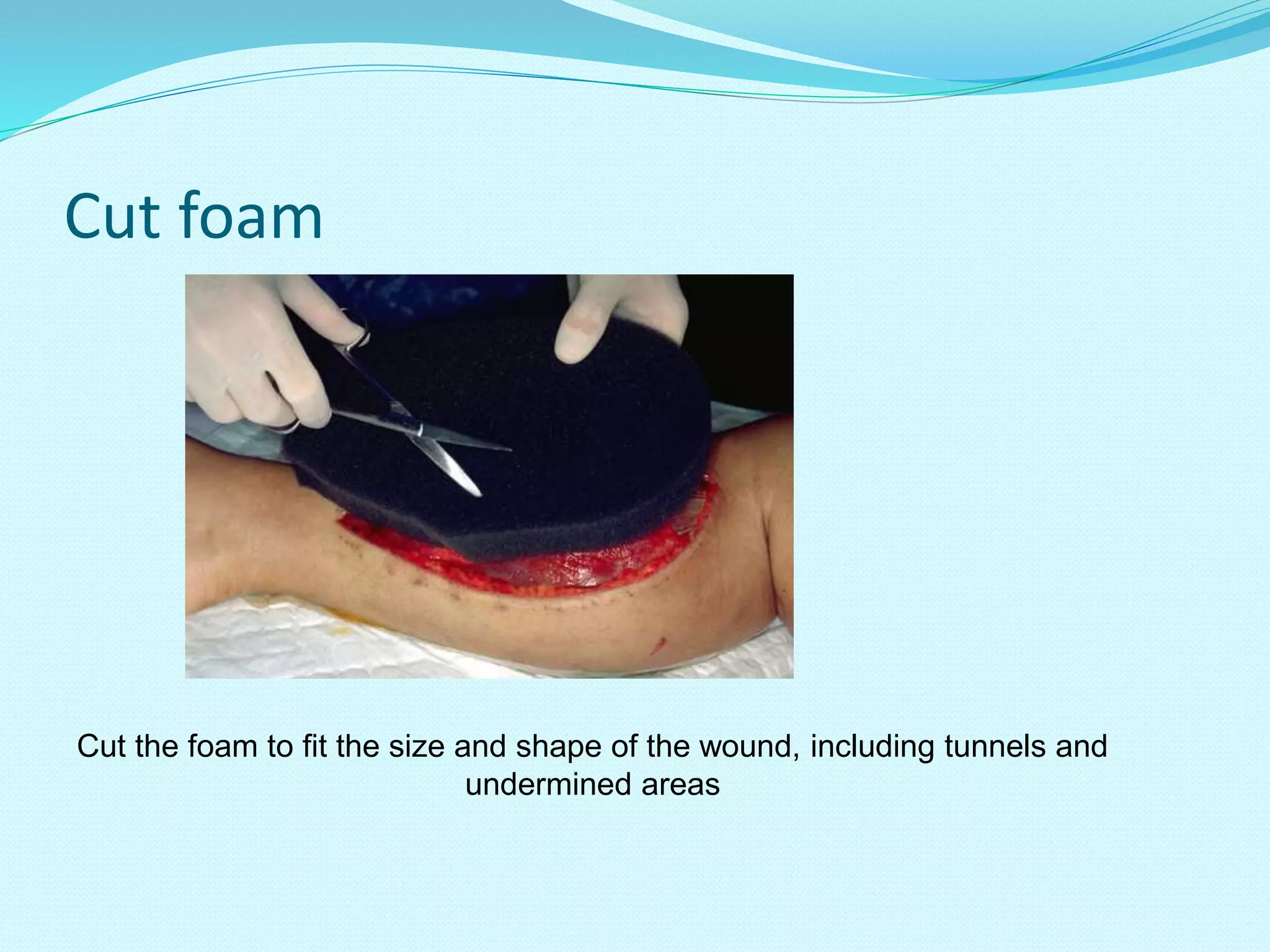 VACUUM ASSISTED WOUND THERAPY | PPTX