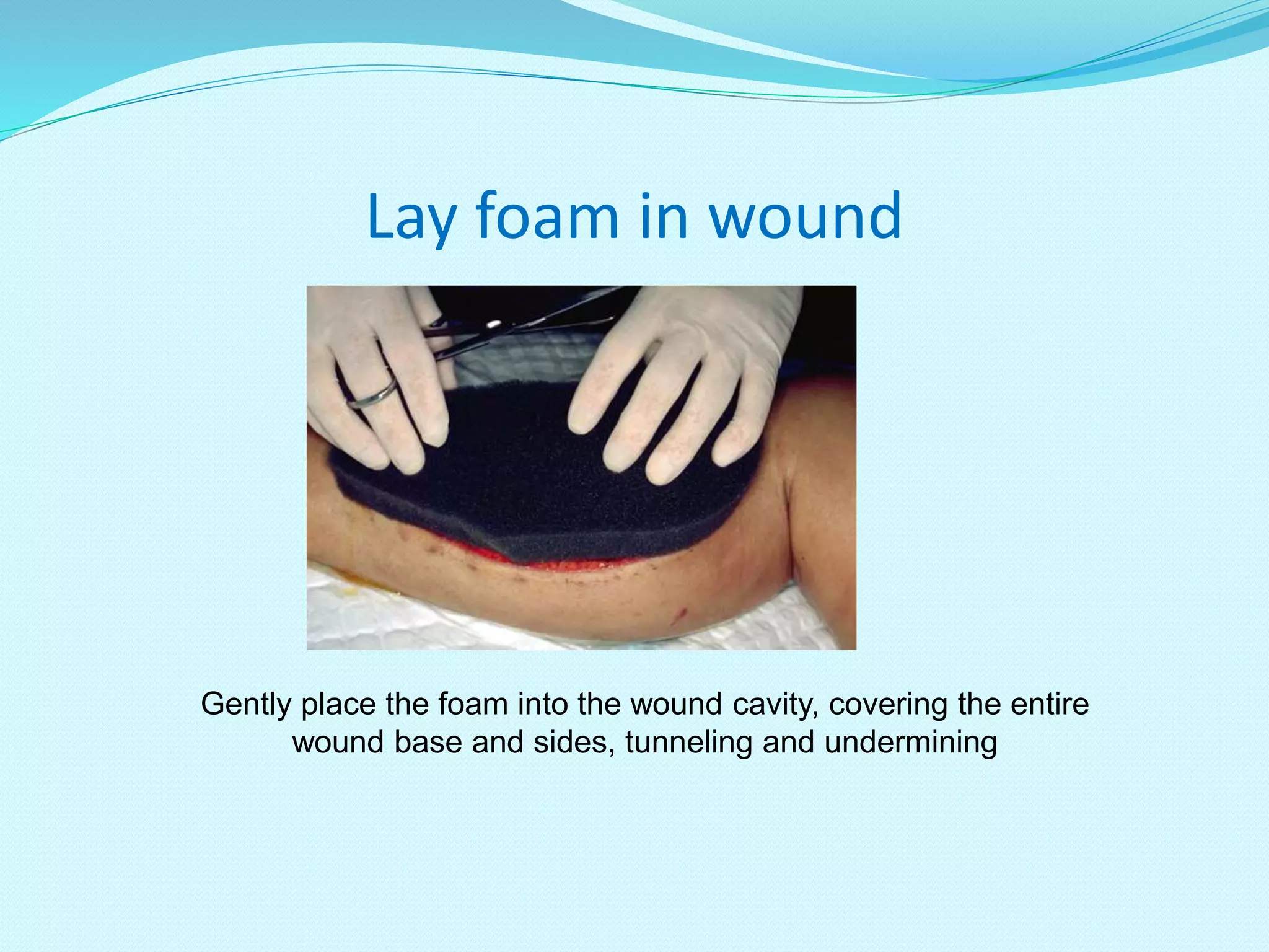 VACUUM ASSISTED WOUND THERAPY | PPTX