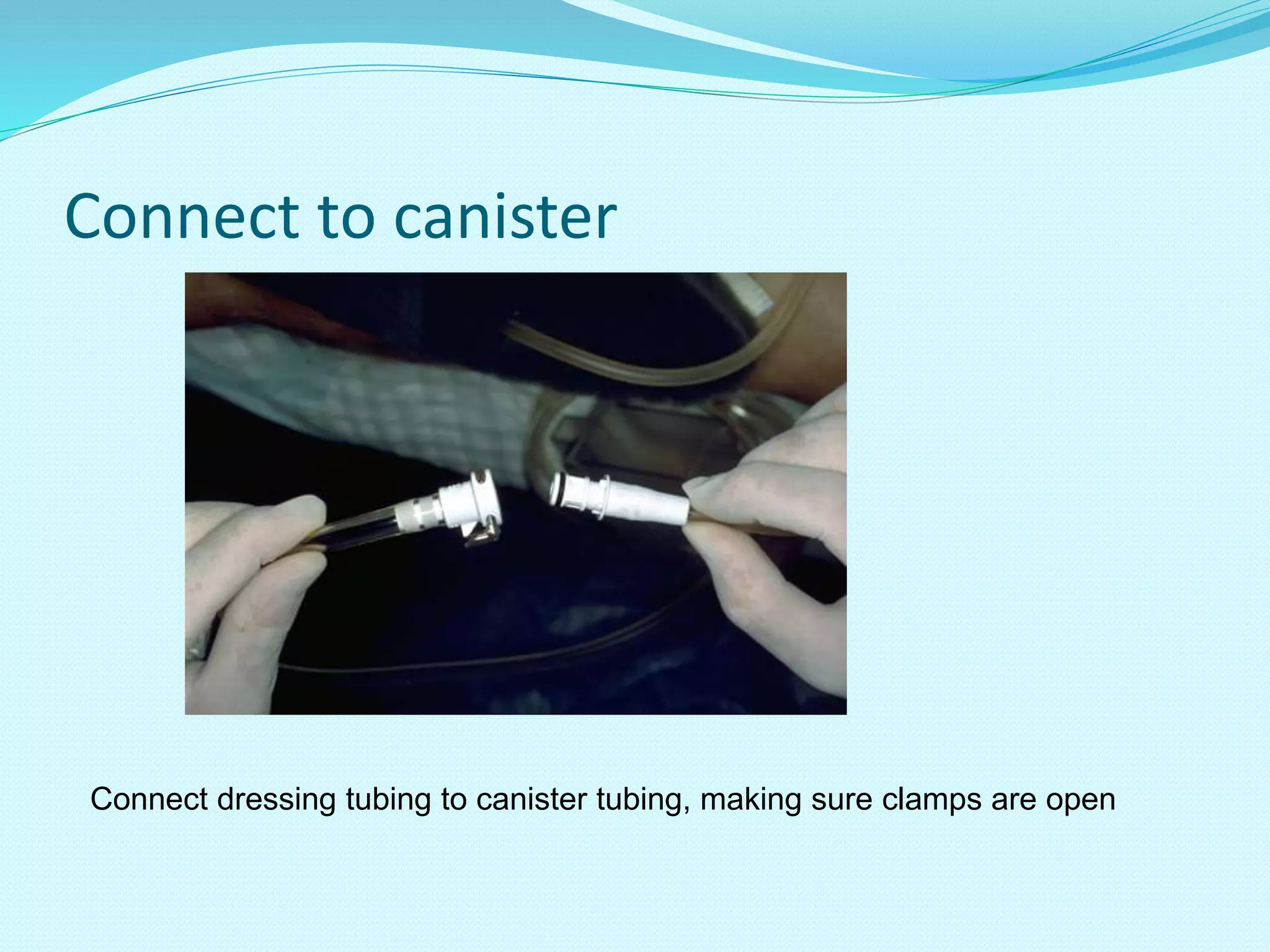 VACUUM ASSISTED WOUND THERAPY | PPTX