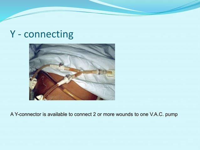 VACUUM ASSISTED WOUND THERAPY | PPTX