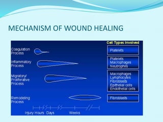 VACUUM ASSISTED WOUND THERAPY | PPTX