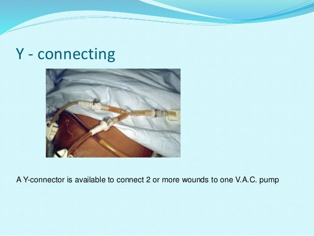 VACUUM ASSISTED WOUND THERAPY