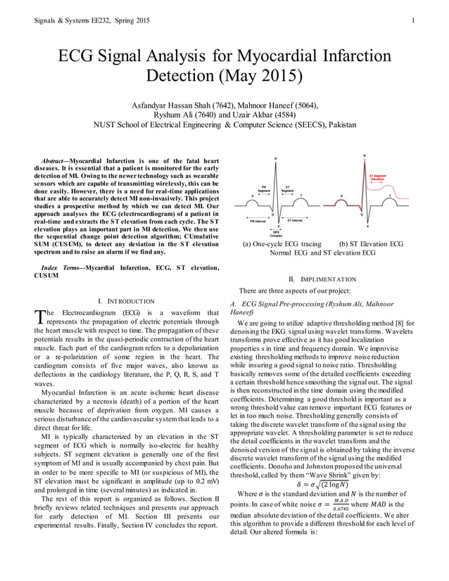 ECG Signal Analysis for Myocardial Infarction Detection | PDF