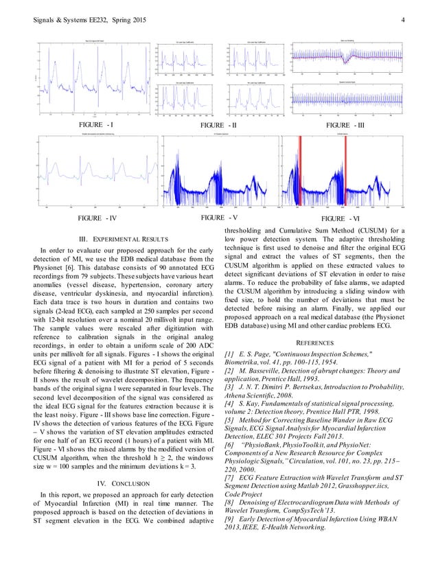 ECG Signal Analysis for Myocardial Infarction Detection | PDF