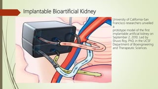Bioartificial Kidney Project skt dr keniz | PPTX