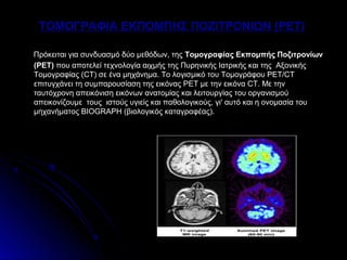 Project teliko 3 | PPT