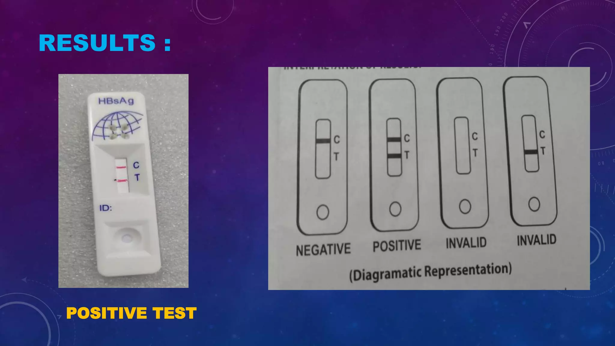 PROJECT WORK on Hepatitis-b rapid card test, HCV Rapid card test ...