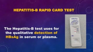PROJECT WORK on Hepatitis-b rapid card test, HCV Rapid card test ...