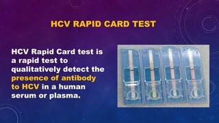 PROJECT WORK on Hepatitis-b rapid card test, HCV Rapid card test ...