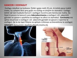 Kanceri,forme e rebelimit qelizor | PPTX