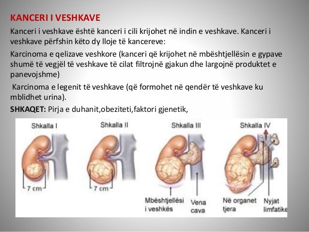 Kanceri,forme e rebelimit qelizor