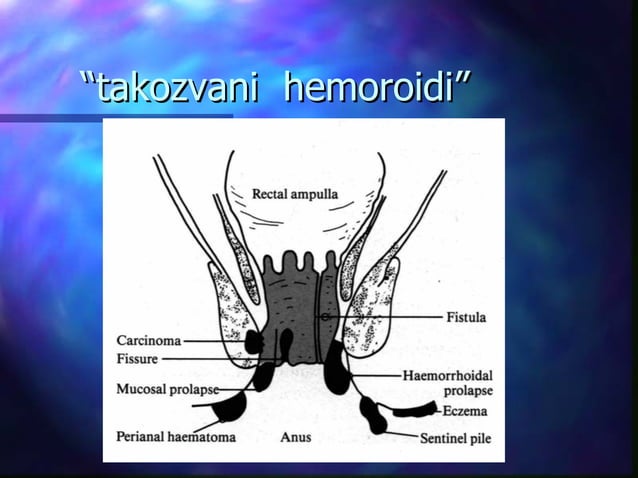 Proktologija Koncna Verzija | PPT