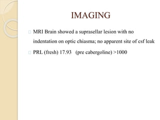 Prolactinorrhoea | PPTX