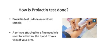 Prolactin test | ODP