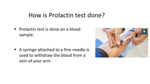 Prolactin test | ODP