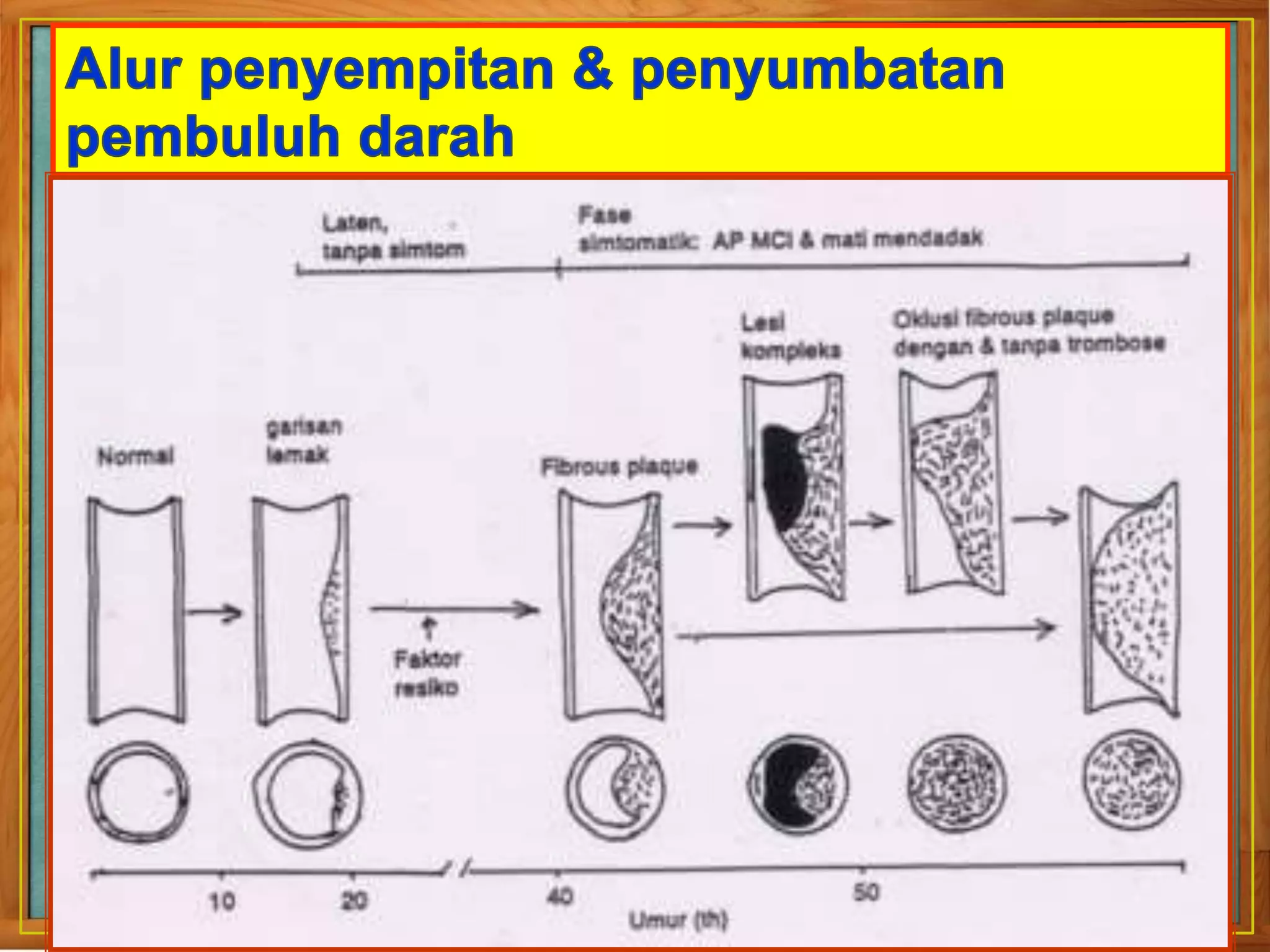 PROLANIS_STROKE.pptx