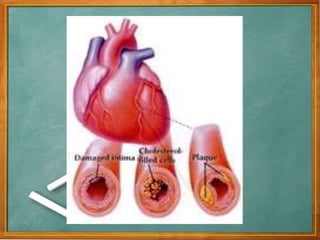 PROLANIS_STROKE.pptx