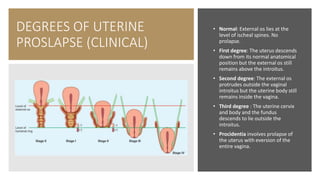 Prolapse | PPT
