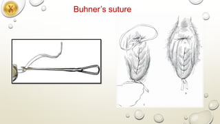 uterine prolapse in goat | PPT