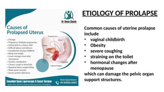 Prolapse basic introduction in medicine, | PPTX