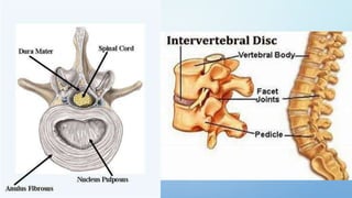 Prolapsed intervertebral disc ppt slideshare | PPTX