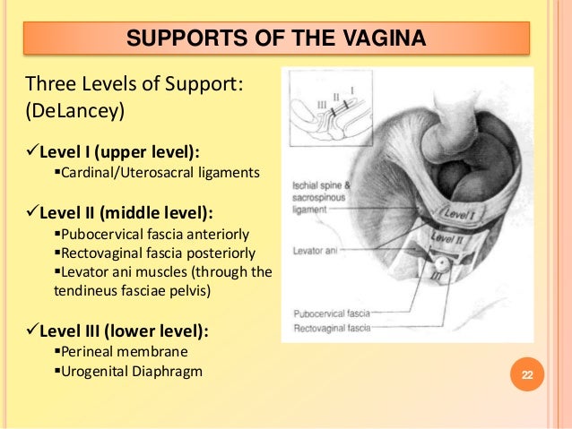 Pelvic Organ Prolapse
