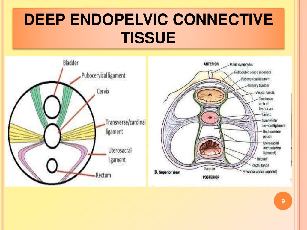 Pelvic Organ Prolapse