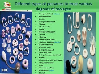 Prolapse management | PPTX