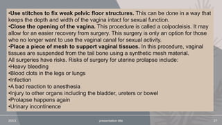 Prolapse of the uterus.pptx