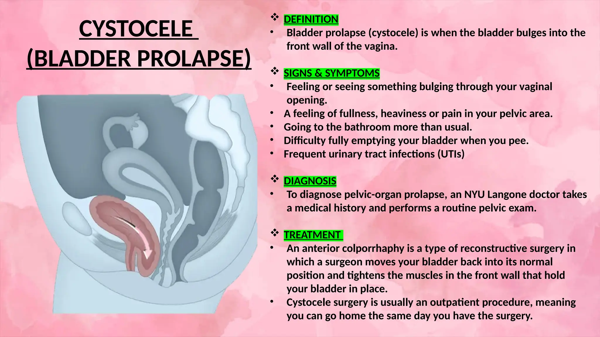 Prolapse Types gynecology practice in medicine | PPTX
