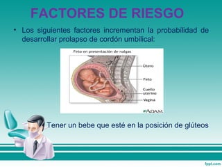 Prolapso de cordon umbilical | PPT