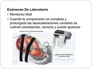 Prolapso de cordon umbilical | PPTX