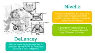 Prolapso de órganos pelvicos | PPTX