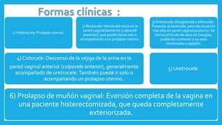 Prolapso de órganos pélvicos | PPTX