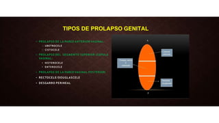 PROLAPSO DE ÓRGANOS PÉLVICOS | PPTX