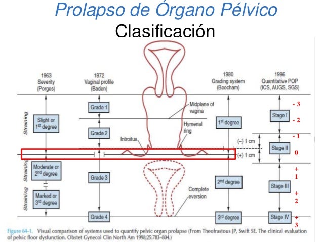 Prolapso genital