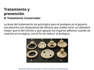 Prolapso genital: histerocele, cistocele y rectocele | PPTX