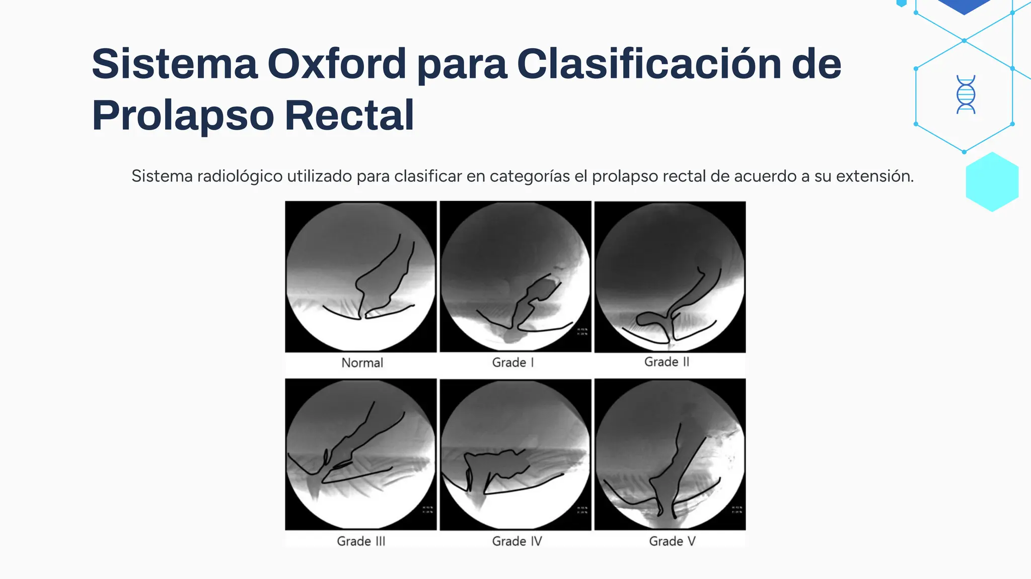 Prolapso Rectal.pdf