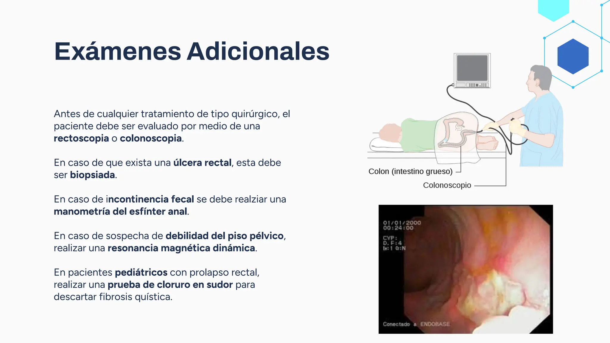 Prolapso Rectal.pdf