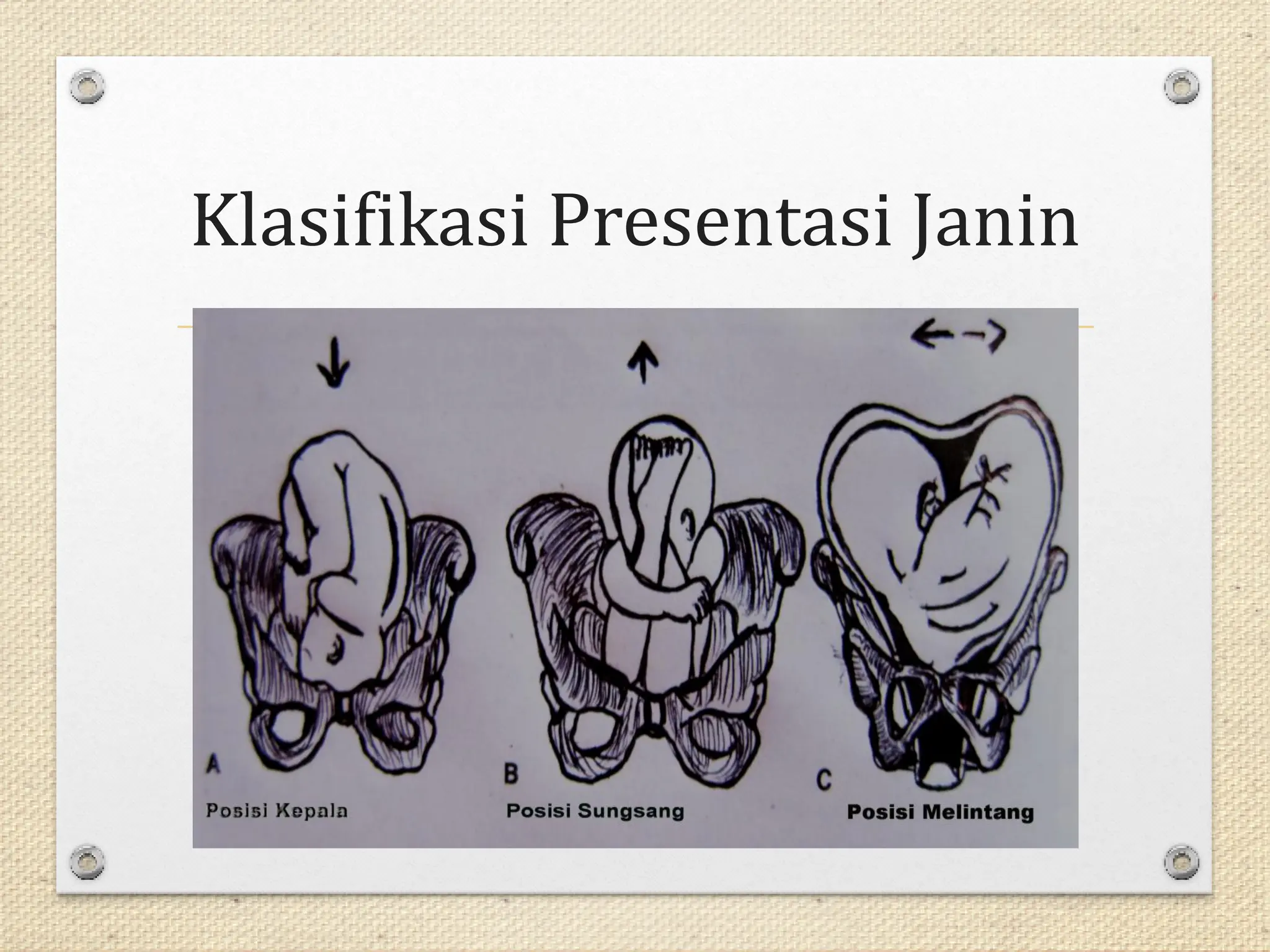 Case prolaps tali pusat, anatom8, fisiologi, patofisiologi | PDF
