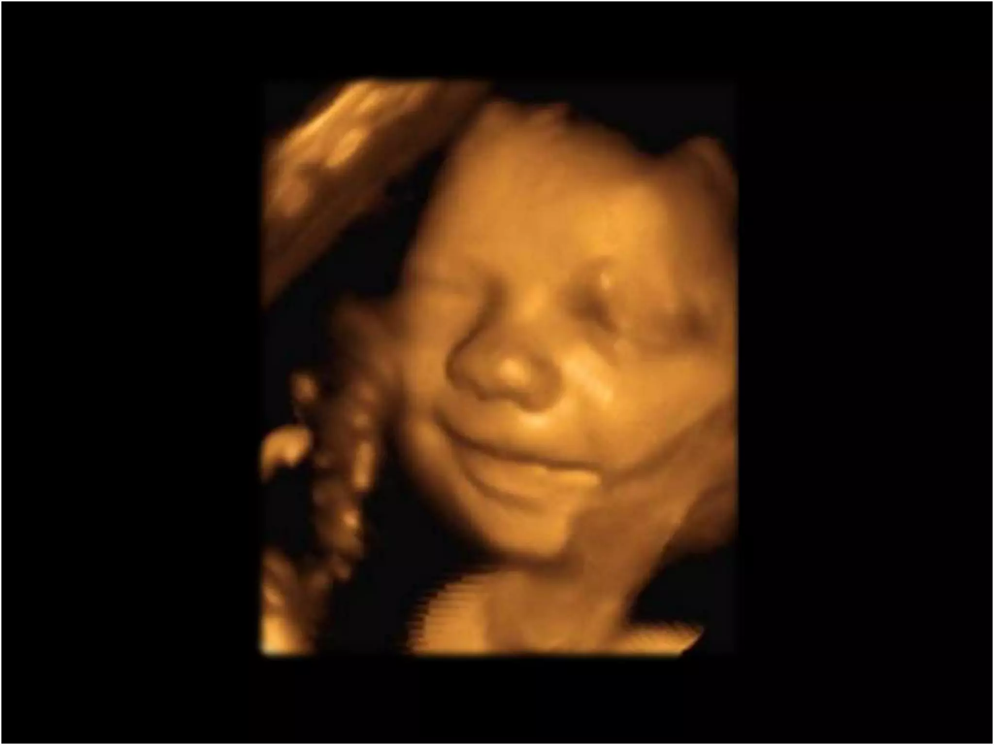 Prolife presentation | PPTX