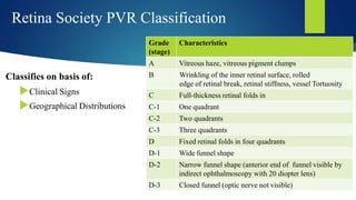 Proliferative Vitreoretinopathy | PPTX
