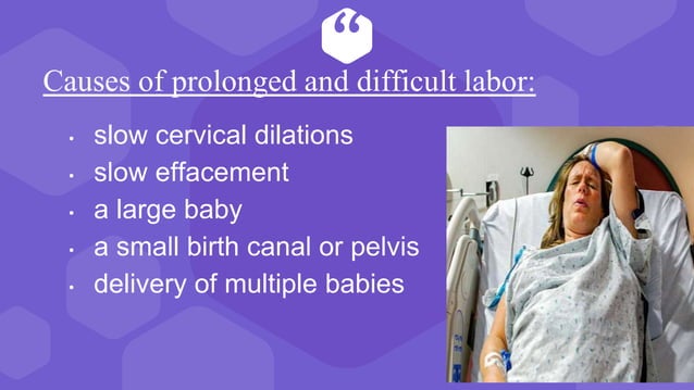 Prolonged-Labor-ppt..pptx