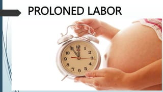 prolonged labor.pptx obg seminar 4th year | PPTX